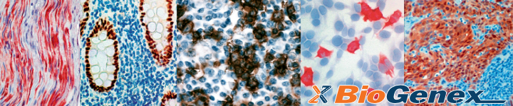 BioGenex | ImTec Diagnostics NV